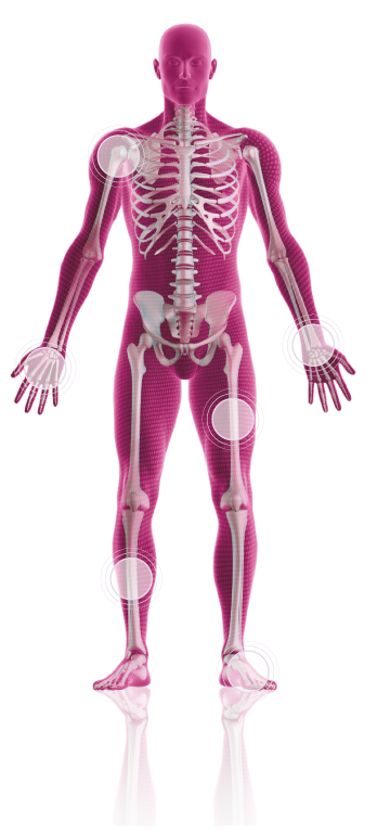 NanoBone® - Biocomposites